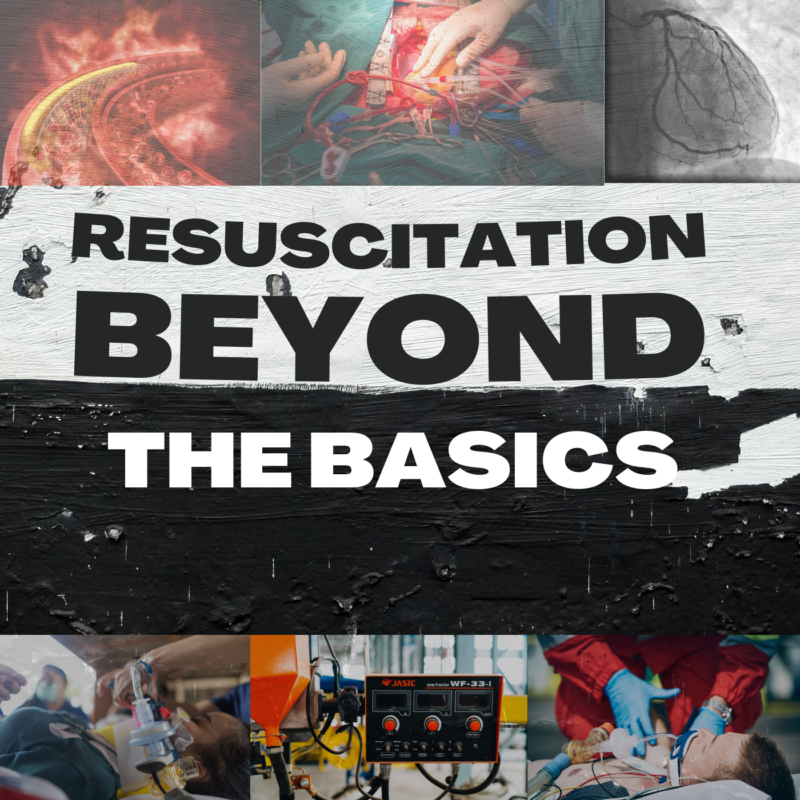 Resuscitation Beyond The Basics Epic Em
