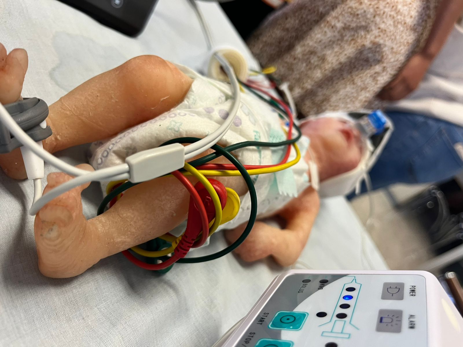 The Lifeline for Our Most Fragile Patients - EPIC EM